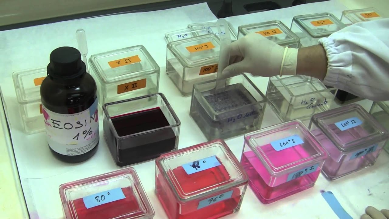 Tinción de Hematoxilina-Eosina en el Laboratorio: PNT Paso a Paso ...